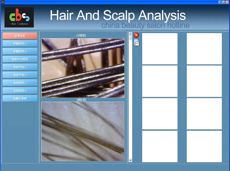 CBS Hair analysis device – Huzhou Lurup Biotechnology Co., Ltd.