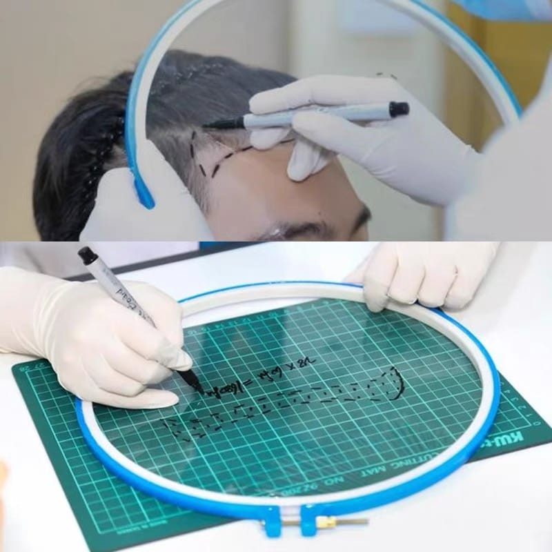 Toolkit for hairline surface area measurement – Huzhou Lurup ...